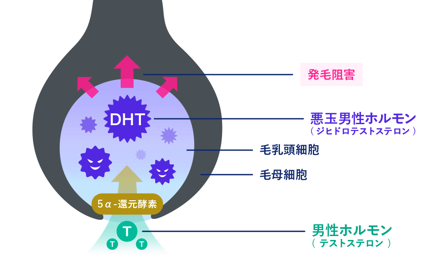 ジヒドロテストステロン（DHT）がAGAの原因？ 抑制する方法も紹介 | 薄毛・抜け毛治療ならAGAヘアクリニック